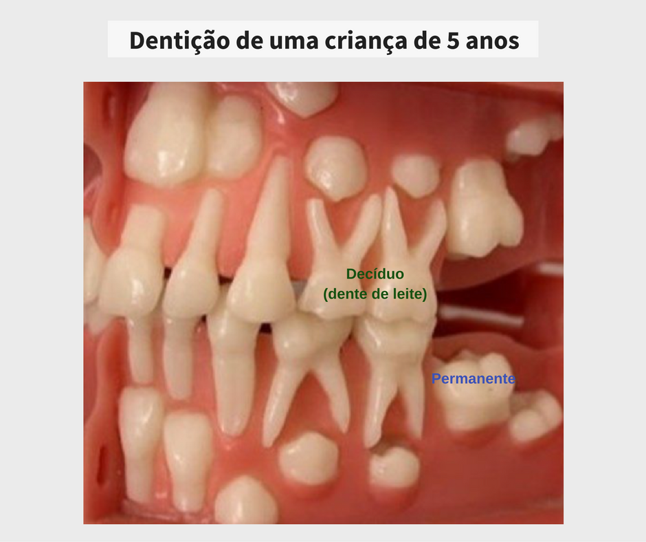Você conhece a cronologia da dentição humana? | OdontoYama