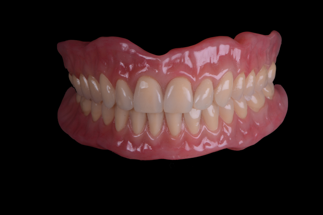 Tipos de Próteses Dentárias - OdontoYama